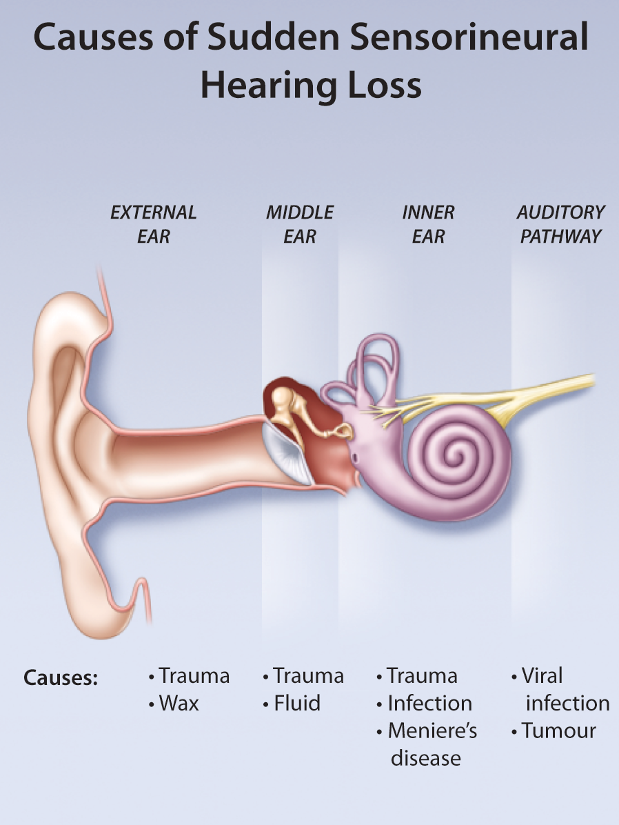 Tinnitus HealthPlexus