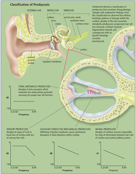 Hearing Loss And Aging The Surprising Side Effects Of Hearing Loss
